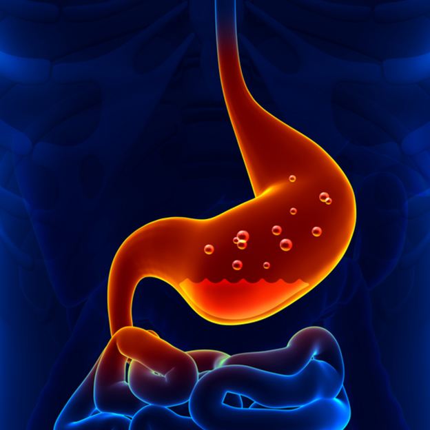 Managing Reflux the Natural Way - BAST Training